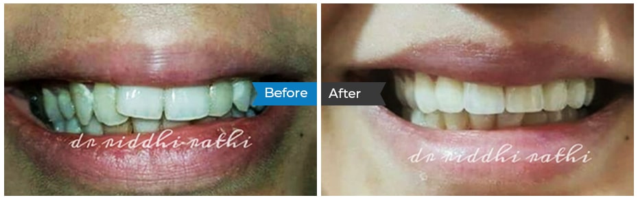 Advanced Dentistry – Orthosquare Multispecialty Dental Chain