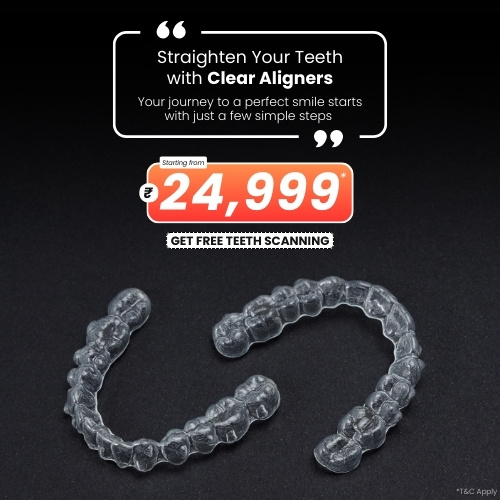 Invisible Aligners – Orthosquare Multispecialty Dental Chain